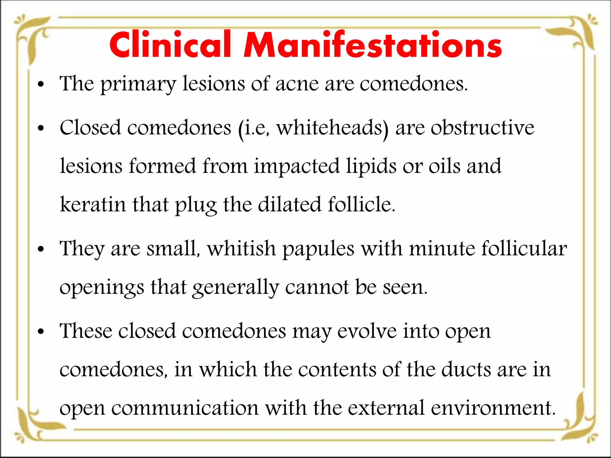 Acne vulgaris | PPTX