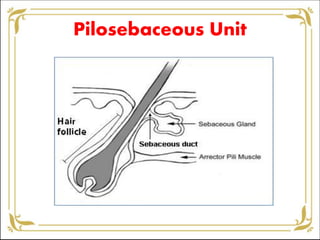Acne vulgaris | PPTX