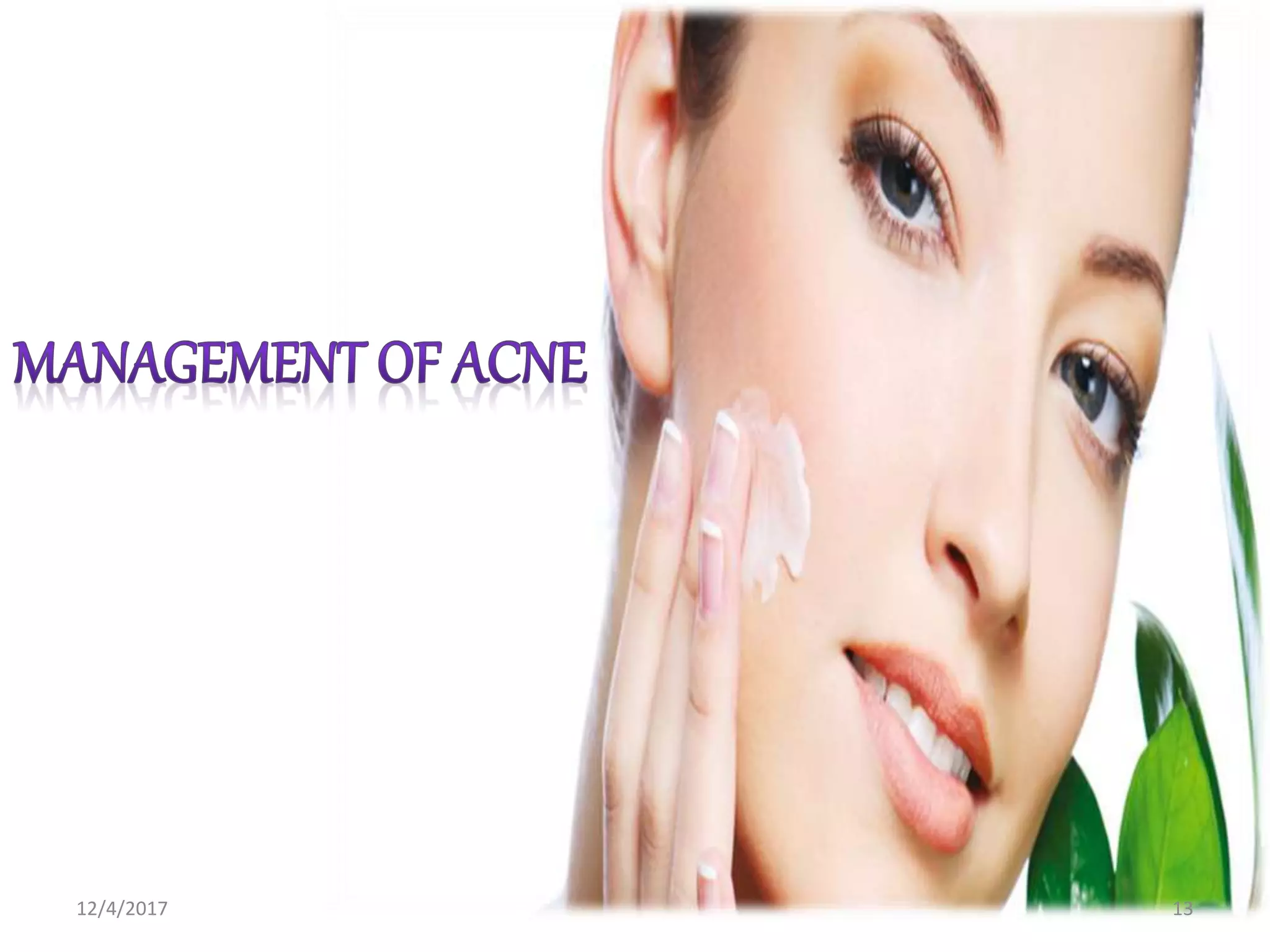 Acne vulgaris | PPTX