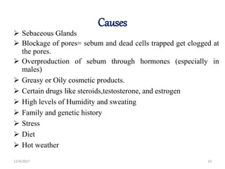 Acne vulgaris | PPT