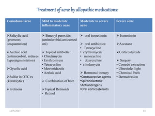 Acne vulgaris | PPTX