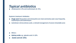 Acne vulgaris | PPTX