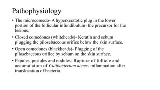 Acne Vulgaris | PPTX