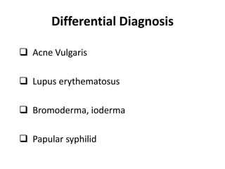 Acne vulgaris....pptx