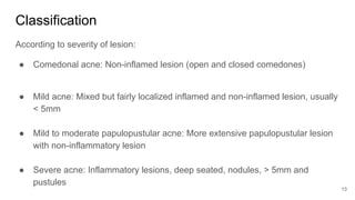 Acne vulgaris.pptx.pdf