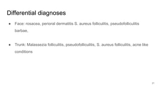 Acne vulgaris.pptx.pdf