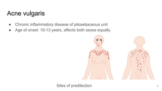 Acne vulgaris.pptx.pdf