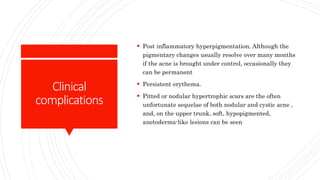 Acne vulgaris(EMBALABE) By: JUDE SSEGANE.pptx