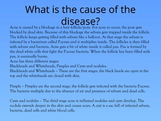 acnevulgaris (pimples on your body) .pptx | Skin and Dermatology ...