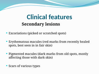 Acne Vulgaris is a chronic inflammatory disease of the pilosebaceous ...