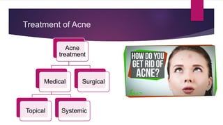 Acne vulgaris approach to topical treatment | PPTX