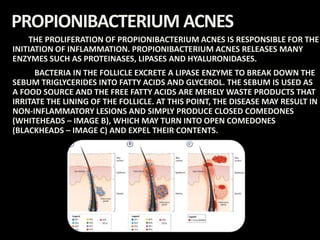 Acne vulgaris dermatology ppt | PPTX