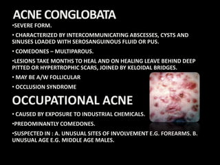 Acne vulgaris dermatology ppt | PPTX