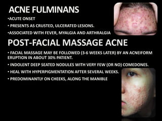 Acne vulgaris dermatology ppt | PPTX