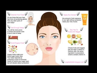 Acne vulgaris dermatology ppt | PPTX