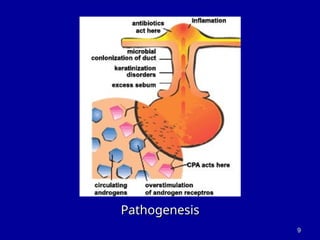 Acne Vulgaris is a chronic inflammatory disease of the pilosebaceous ...