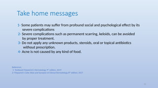 Acne vulgarisN.pptx................................... | PPTX