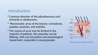 Acne vulgarisN.pptx................................... | PPT