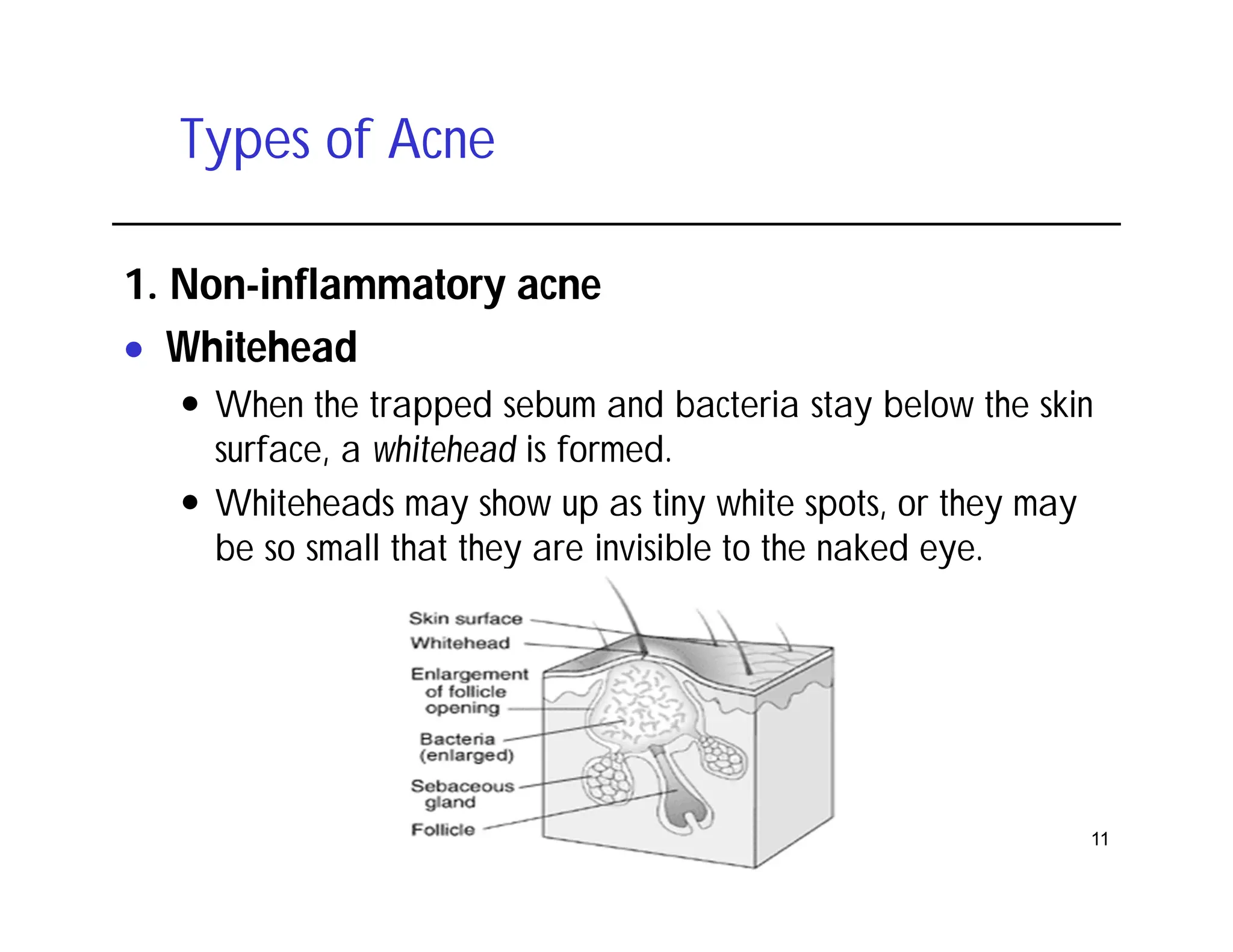 Acne vulgaris, psoriasis and atopic dermatitis handout_2.pdf