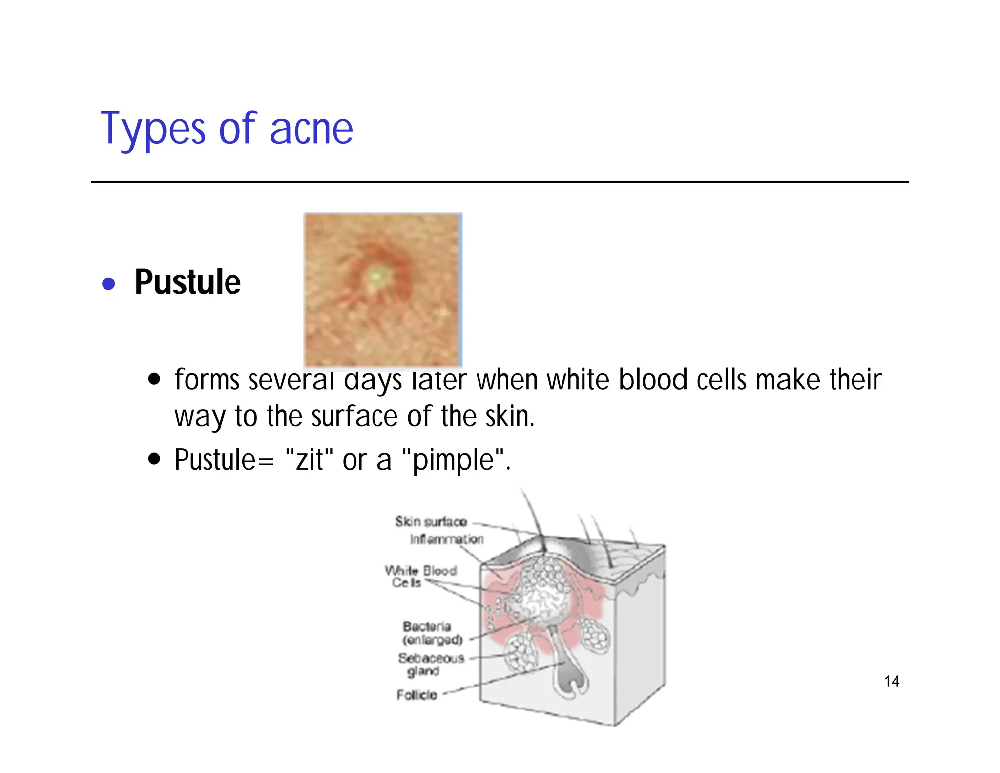 Acne vulgaris, psoriasis and atopic dermatitis handout_2.pdf
