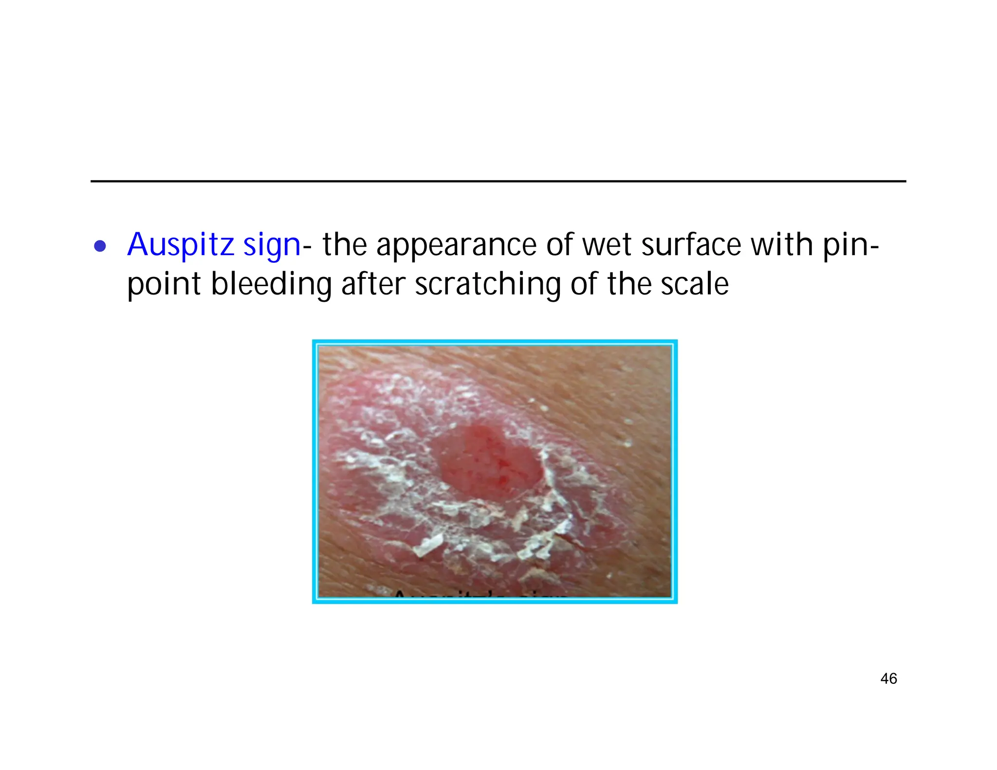Acne vulgaris, psoriasis and atopic dermatitis handout_2.pdf