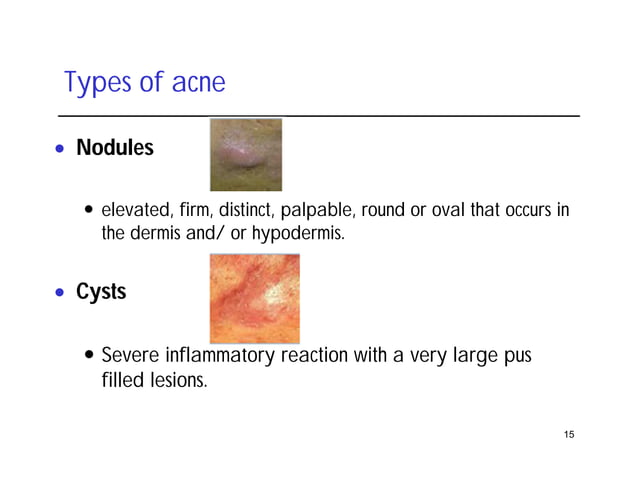 Acne vulgaris, psoriasis and atopic dermatitis handout_2.pdf | Skin ...