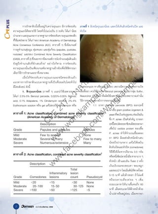 Acne vulgaris treatment & management | PDF