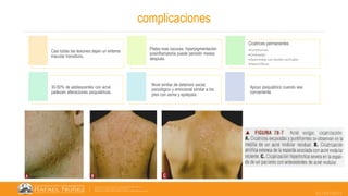 Acné vulgar y erupciones acneiformes.pptx