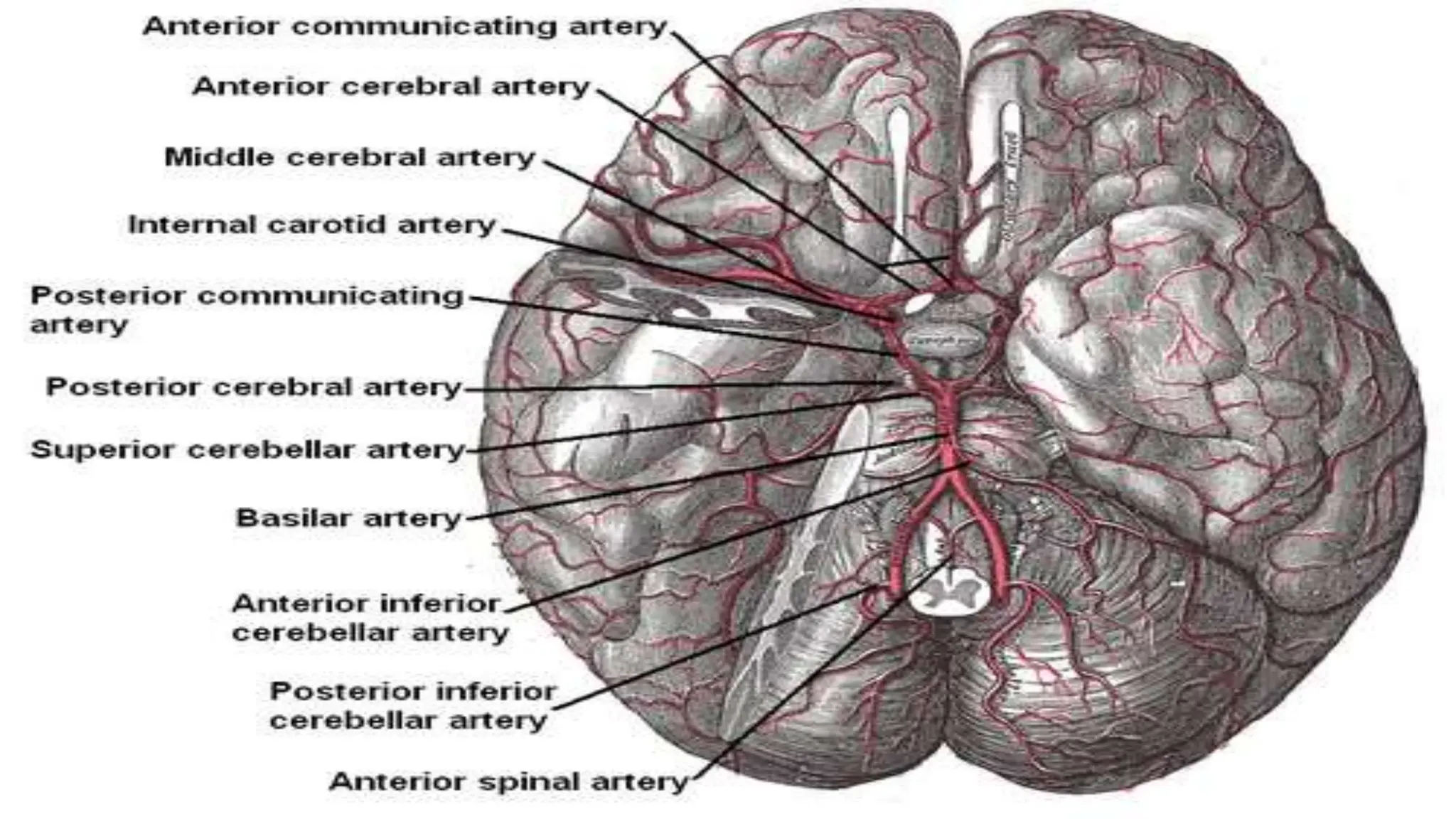 ACOM ANEURYSM Presentation slide share.. | PPTX