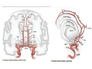 Acom aneurysm | PPTX