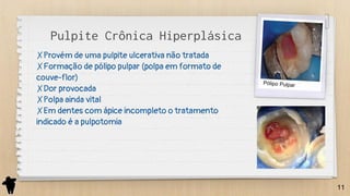 Acometimentos Pulpares - Diferenças Entre Pulpite Aguda e Crônica ...