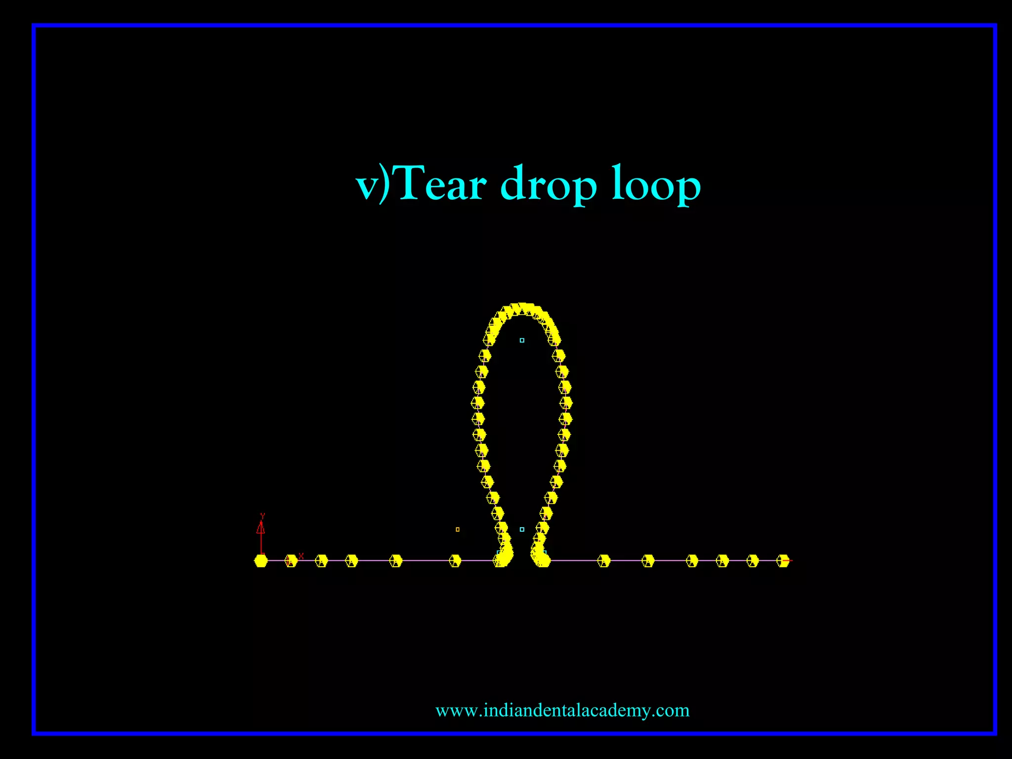 A Comparative Analysis Of Commonly Used Retraction Loops Ppt