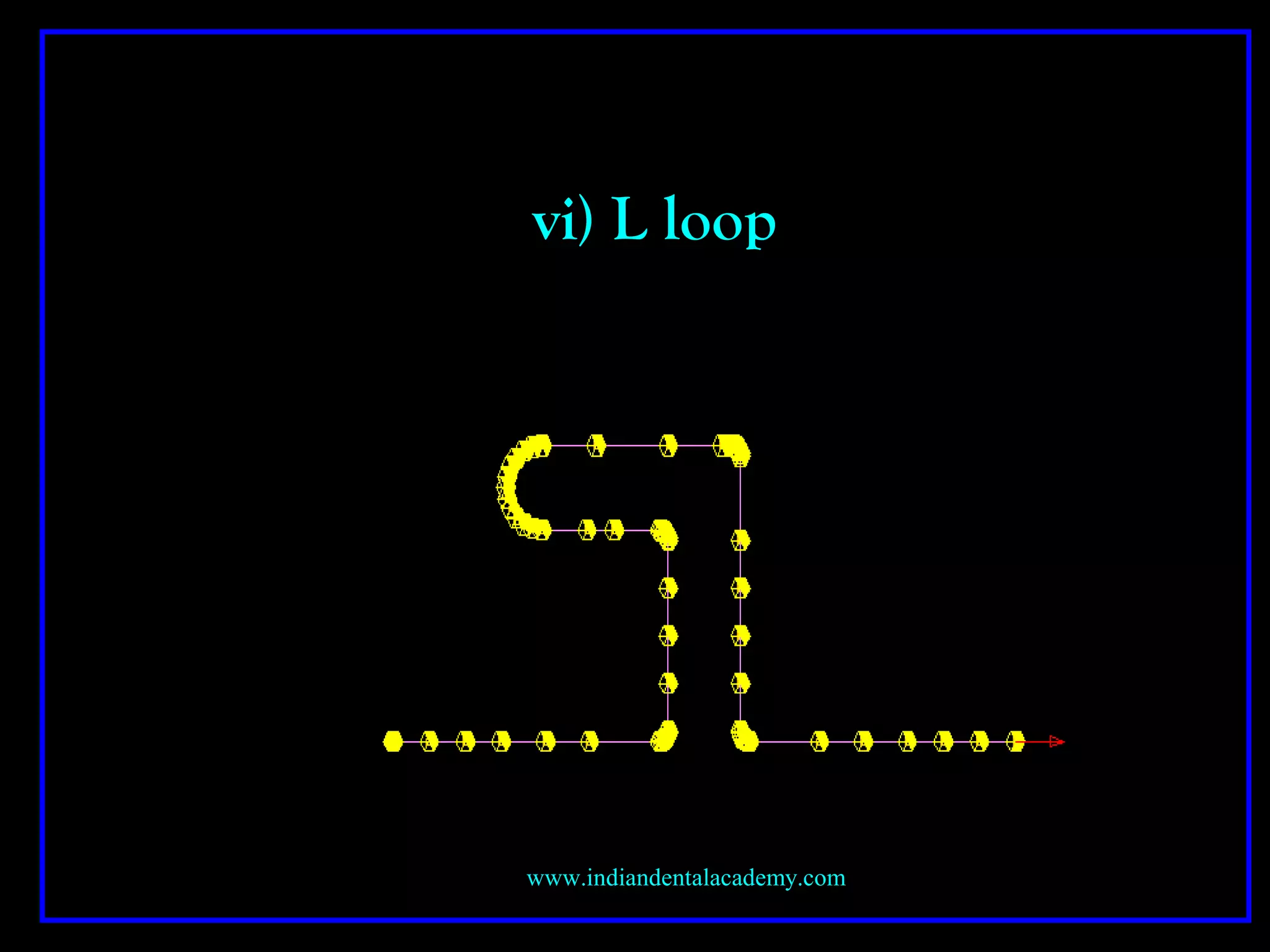 A Comparative Analysis Of Commonly Used Retraction Loops Ppt Physics Science
