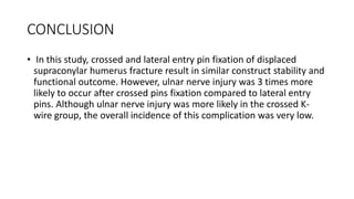 A comparison between percutaneous cross k wire and lateral k wires ...