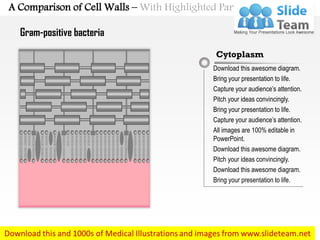 Gram Positive Vs Gram Negative Slide