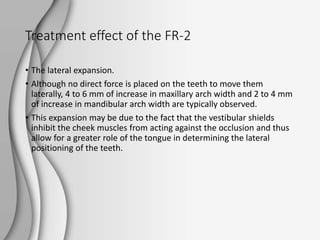d Frankel appliances in the treatment oA comparison of the Herbst anf ...