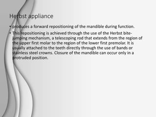 d Frankel appliances in the treatment oA comparison of the Herbst anf ...