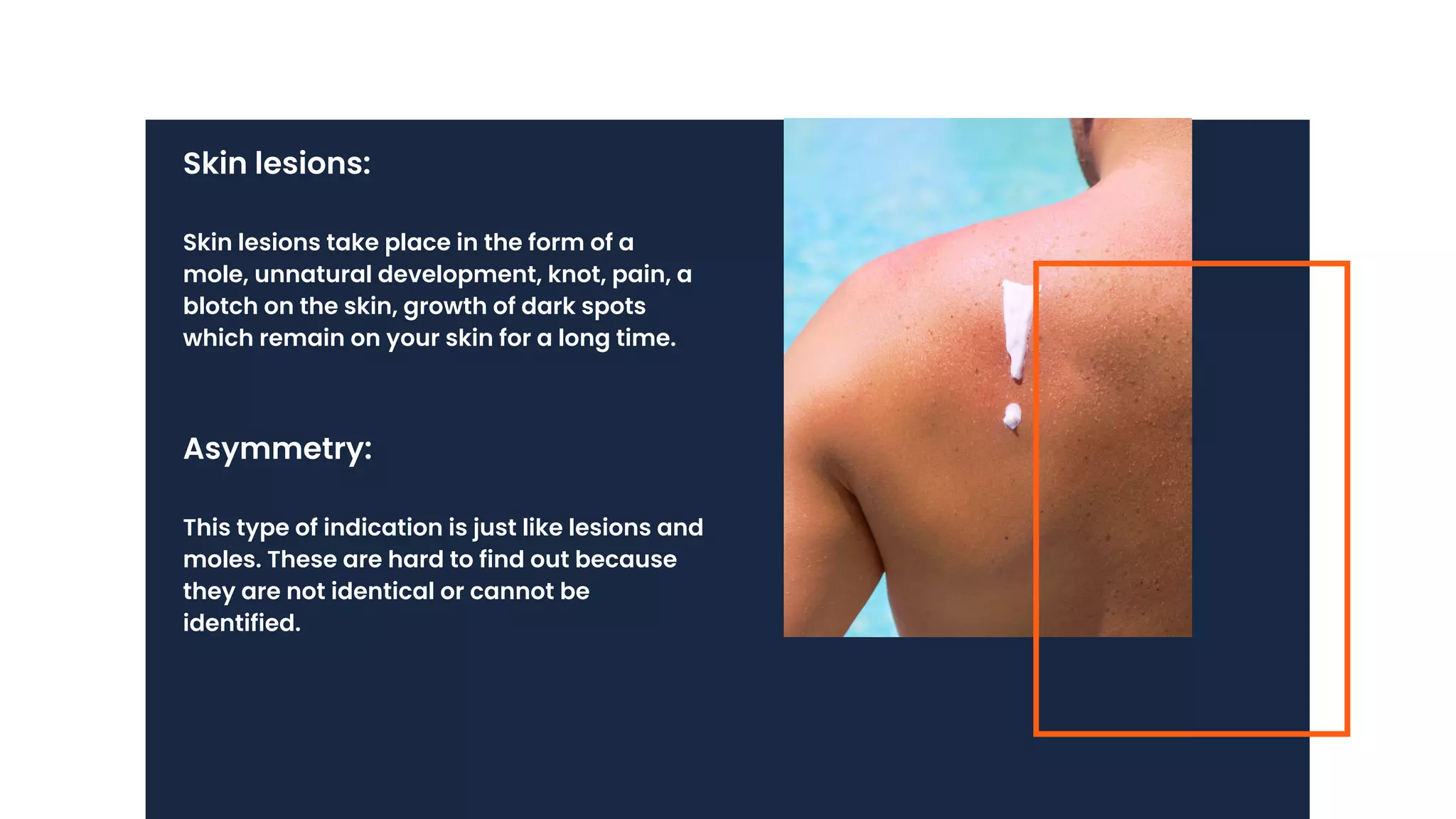 A complete guide on skin cancer.pdf
