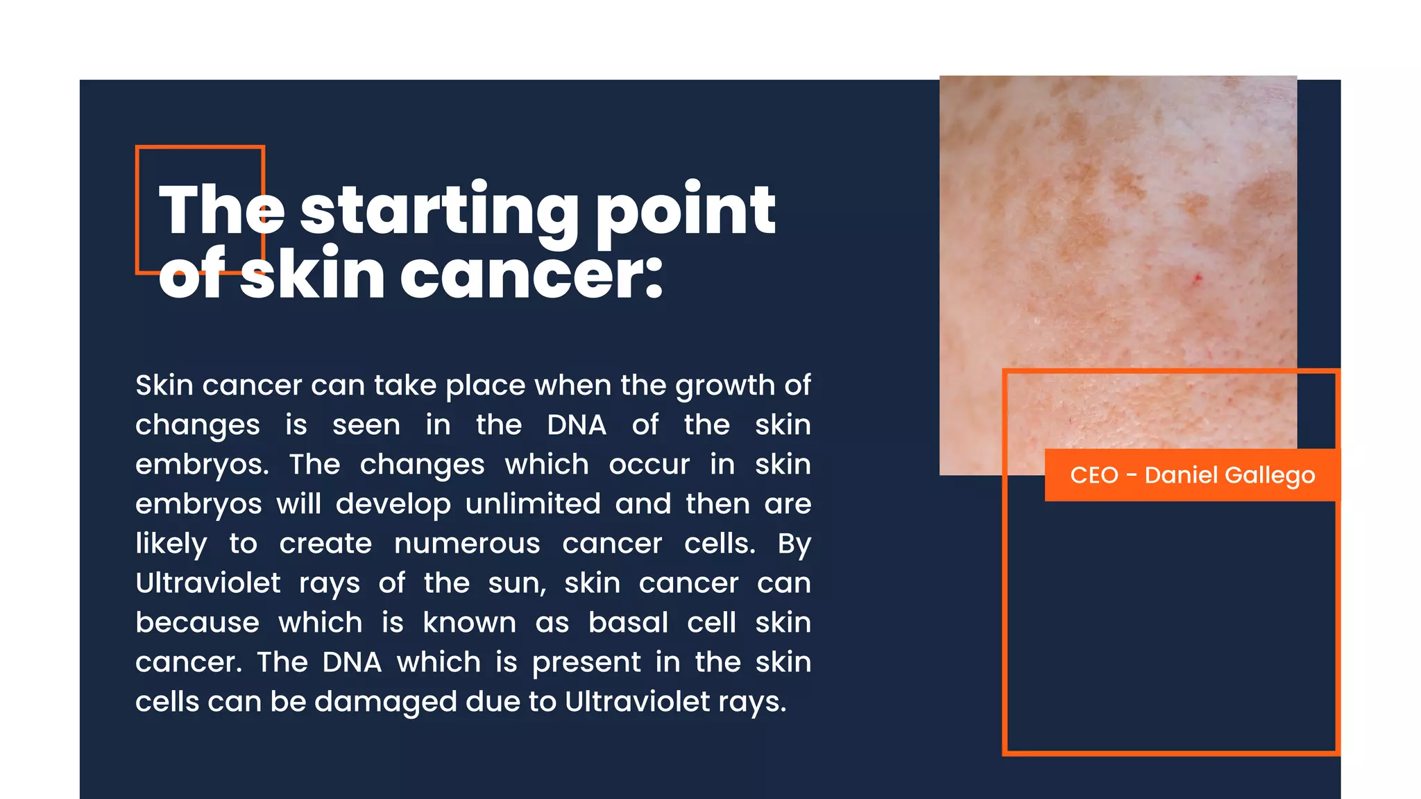 A complete guide on skin cancer.pdf