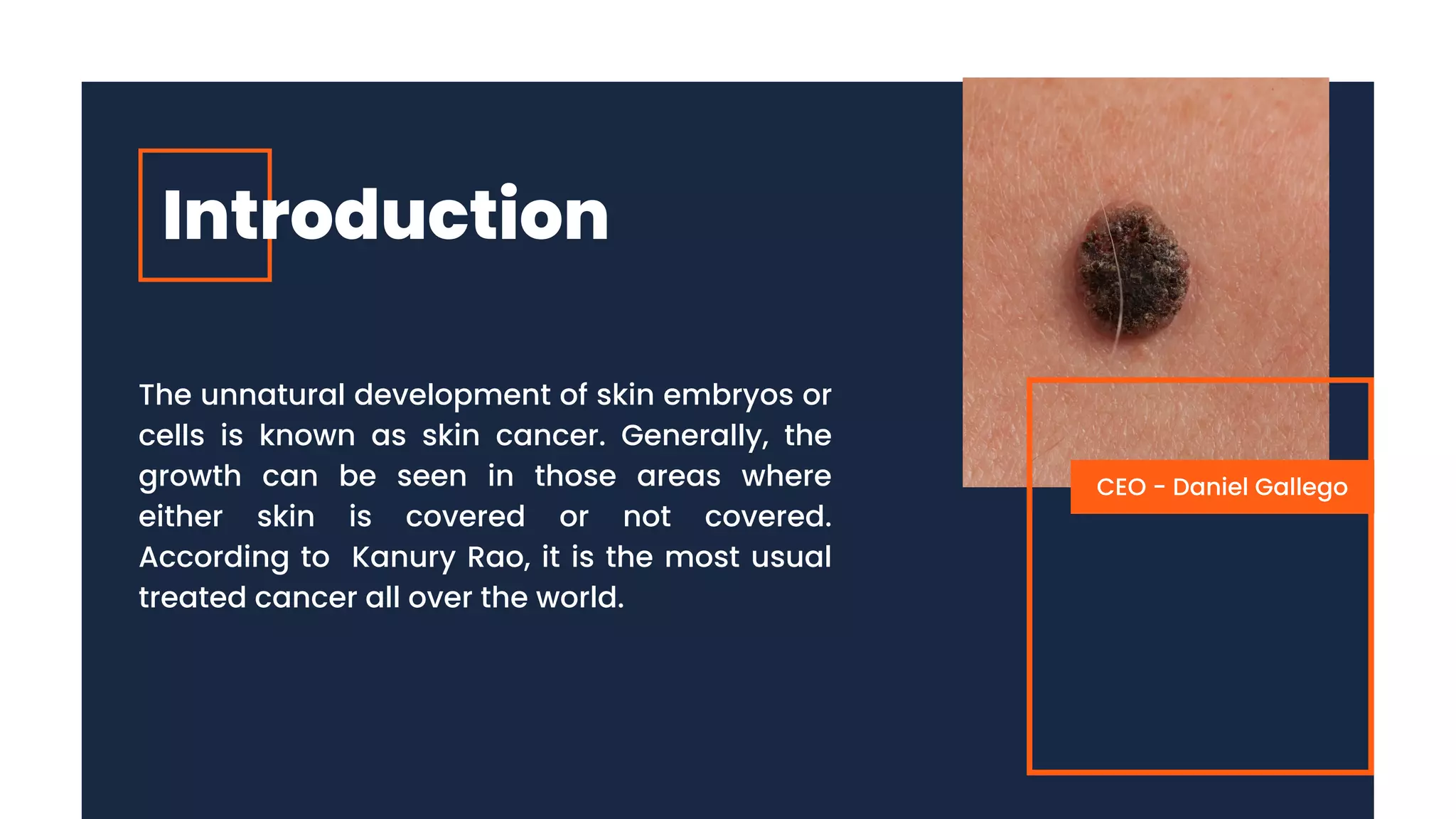 A complete guide on skin cancer.pdf