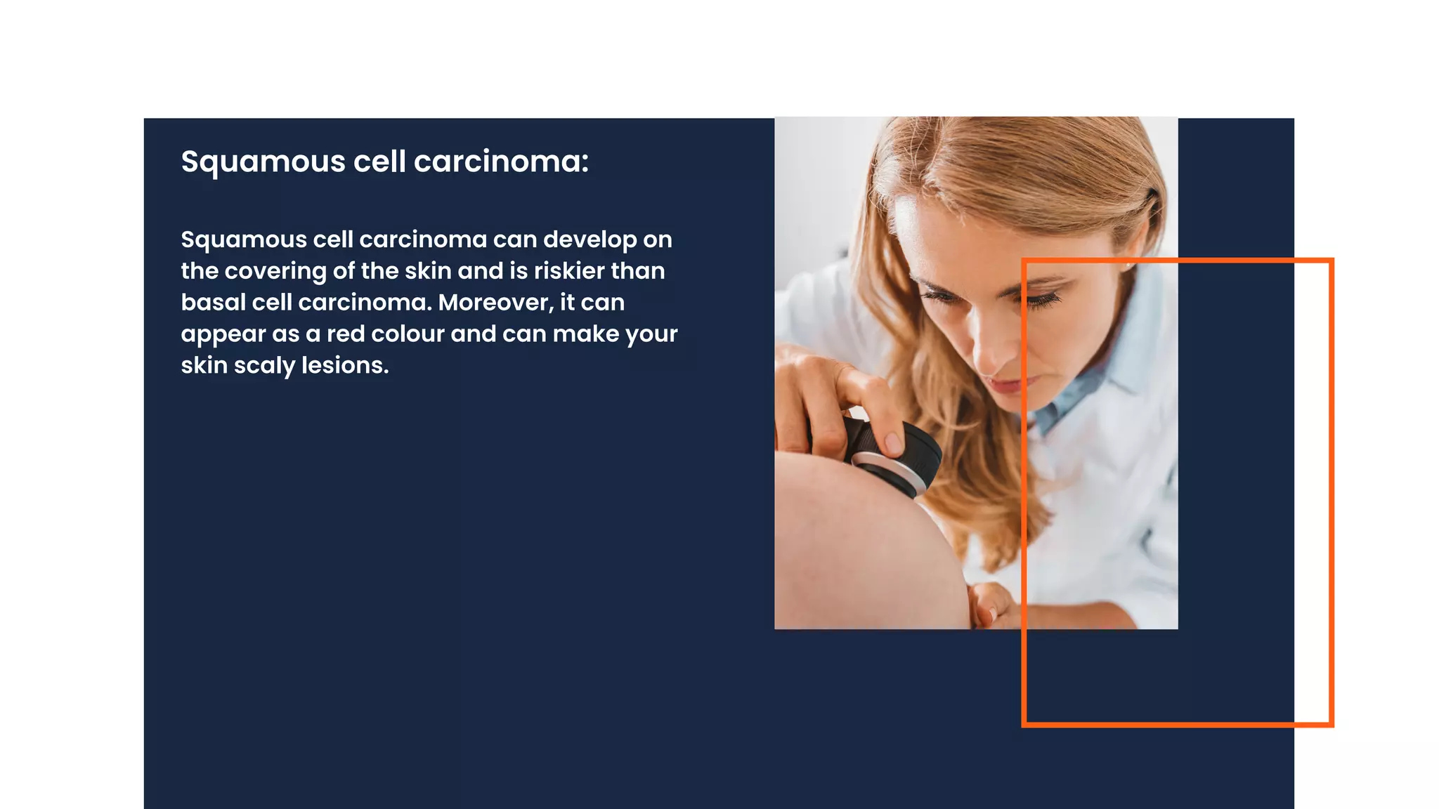 A complete guide on skin cancer.pdf