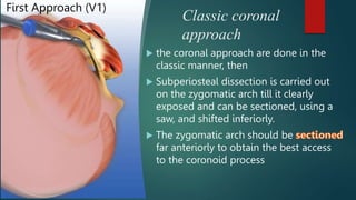 A comprehensive approach to longstanding facial paralysis based on ...