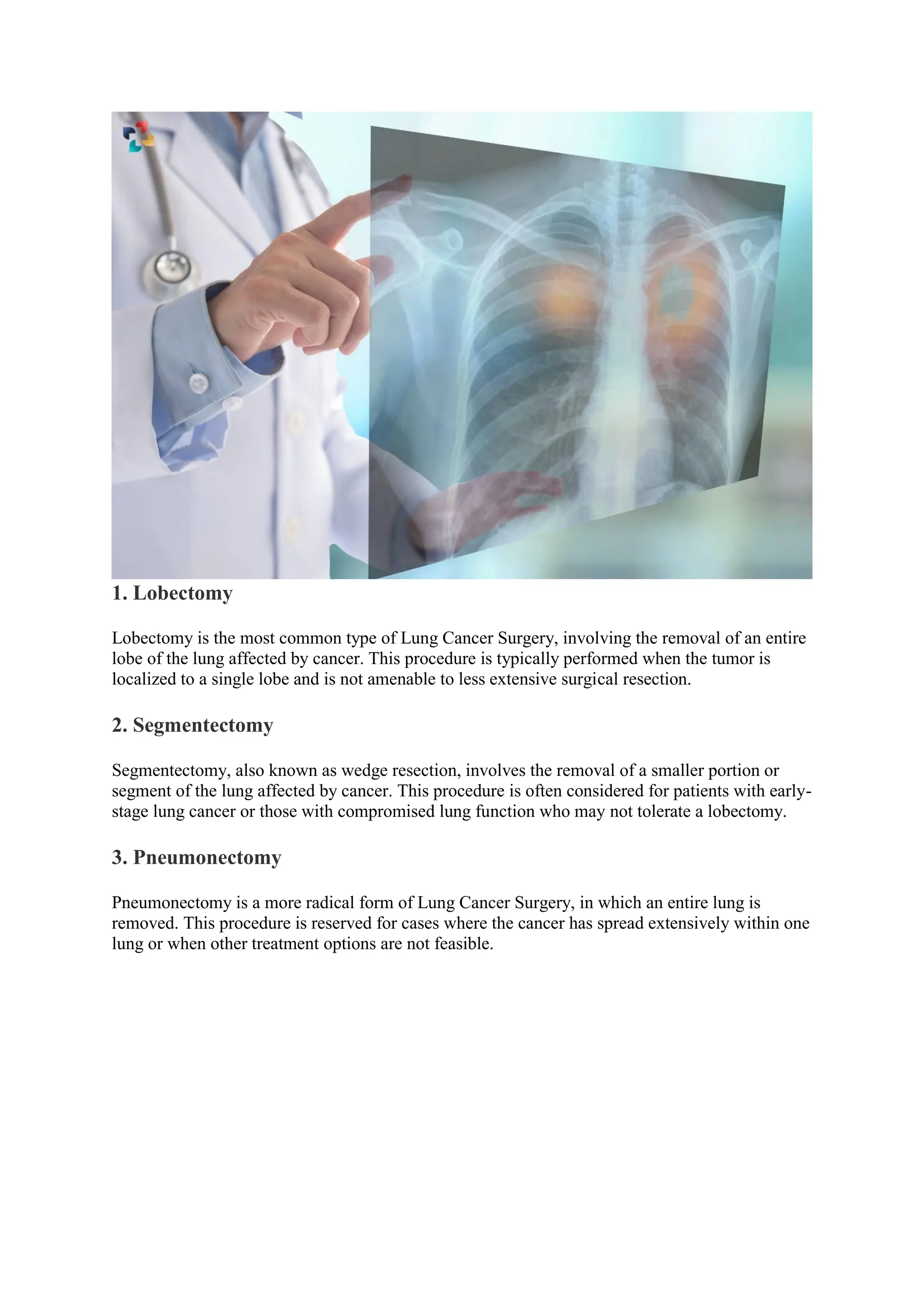 Lung Cancer Surgery: Types, Procedures, and Recovery | The Lifesciences ...