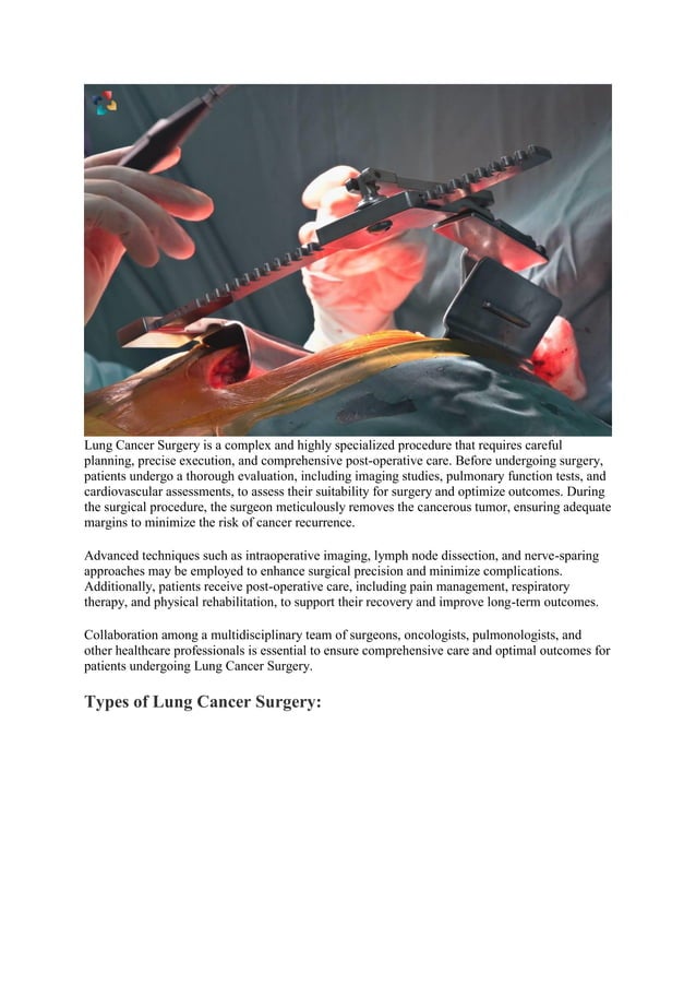 Lung Cancer Surgery: Types, Procedures, and Recovery | The Lifesciences ...