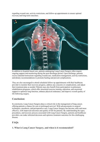 Lung Cancer Surgery: Types, Procedures, and Recovery | The Lifesciences ...