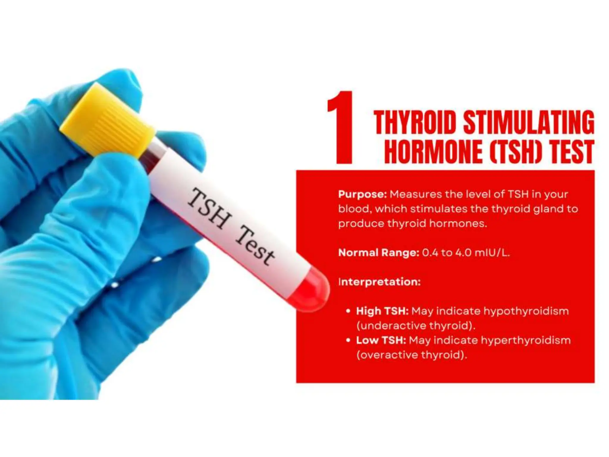 Understanding Thyroid Function Tests: An Overview | PPT