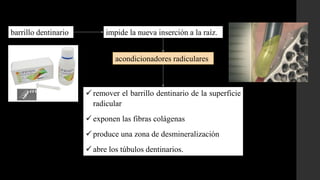 Acondicionamiento radicular en Periodoncia | PPTX