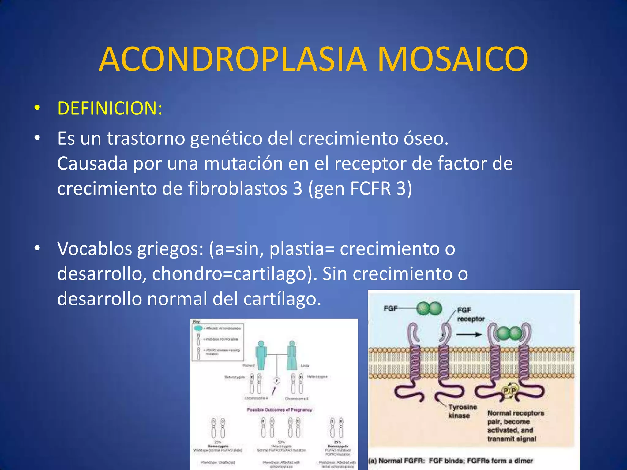 Acondroplasia | PPTX
