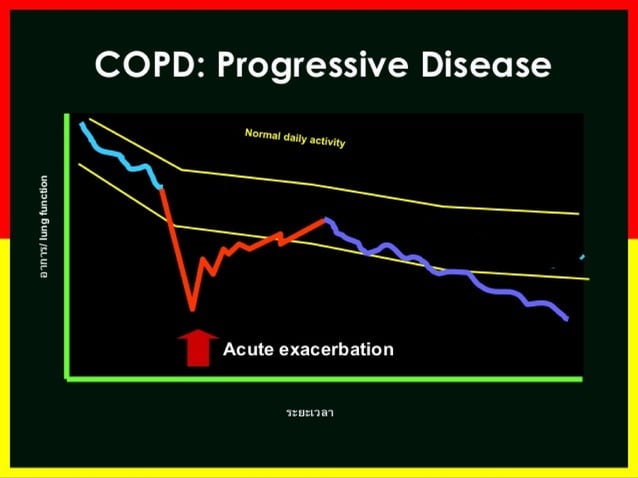 Management of Acute Exacerbztions of COPD at home | PPT