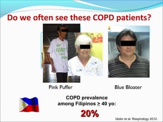 Asthma-COPD Overlap Syndrome - ACOS | PPT
